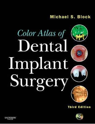 Color Atlas of Dental Implant Surgery: 3e, â2011