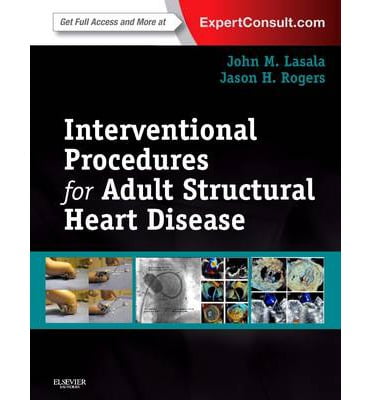 Interventional Procedures for Adult Structural Heart Disease