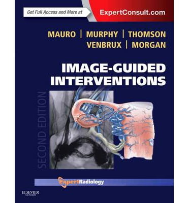 Image-Guided Interventions