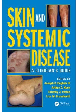 Skin and Systemic Disease : A Clinician's Guide - FAHASA.COM