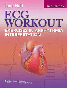 ECG Workout : Exercises in Arrhythmia Interpretation