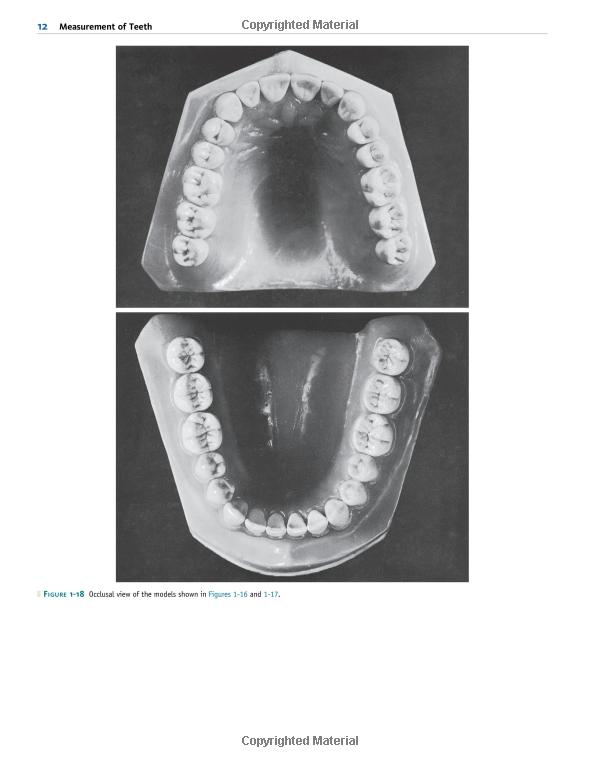 Wheelers Dental Anatomy
