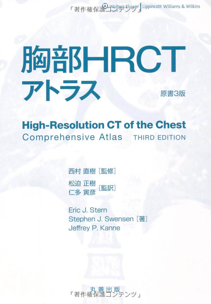 胸部 HRCT アトラス - High-Resolution CT Of The Chest Comprehensive Atlas ...